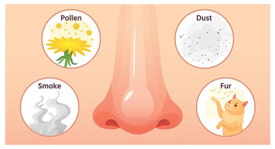 Application of probiotics in the treatment of allergic rhinitis ...